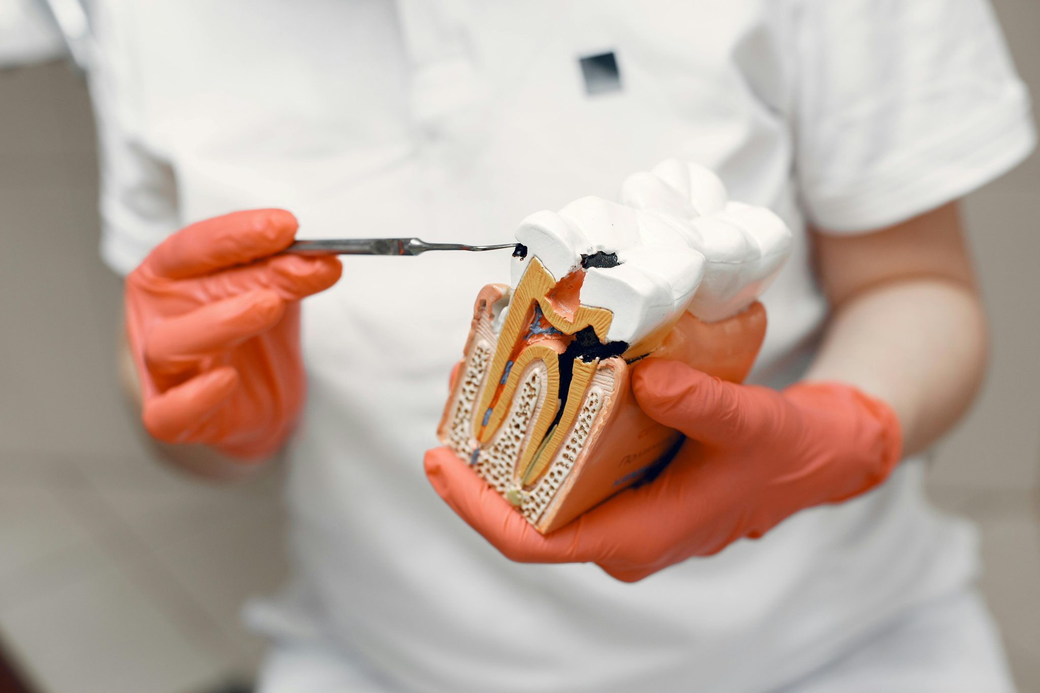 Root Canal Before and After: What to Expect | Brookmere Dental